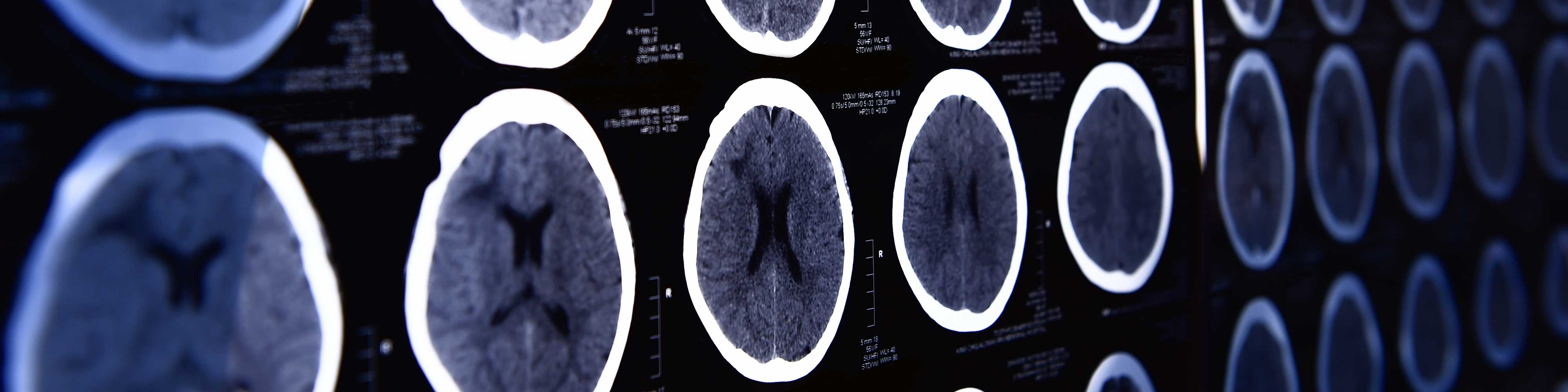 Getting our head around the brain - Curious